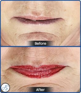 Before and After Photos of Clients at Jaudon Sunde